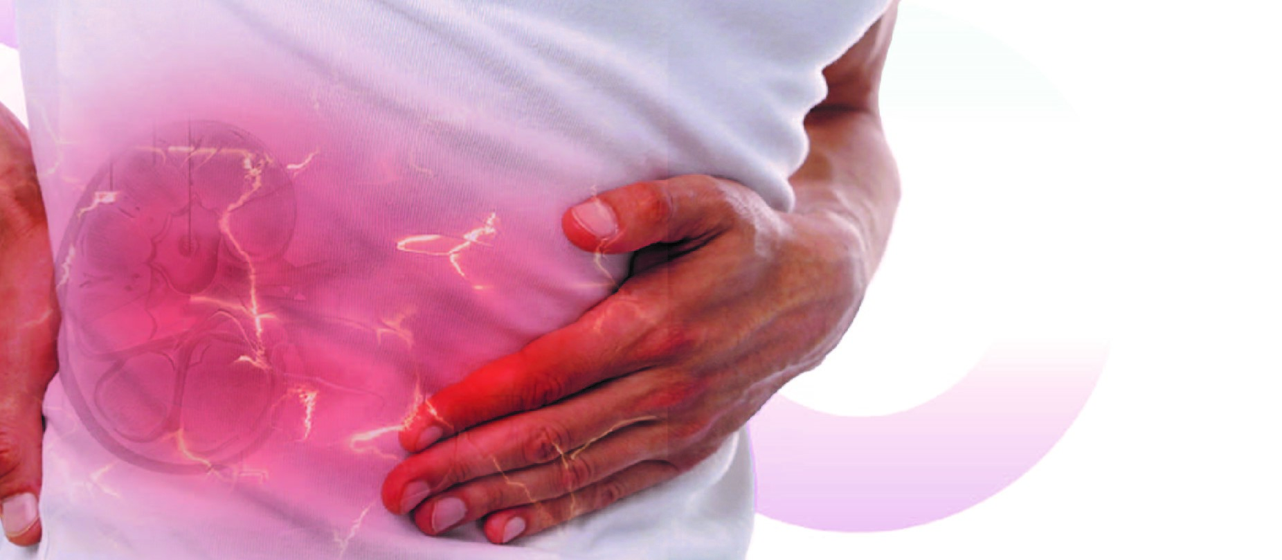 ¿Cómo abordamos desde UROLF el Cólico Renoureteral? – Urología ...